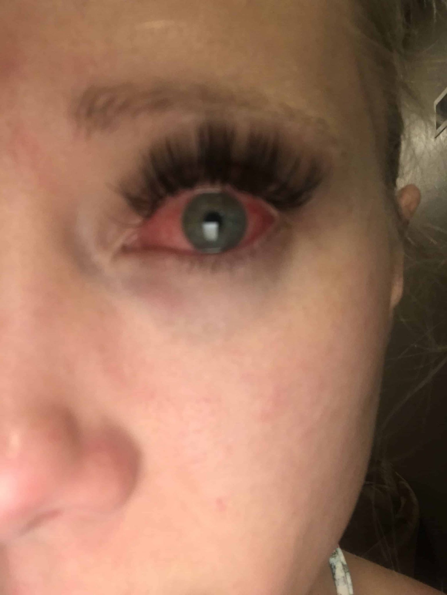 Red Eyes After Eyelash Extensions | Causes & Prevention - Blushastic