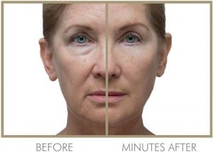 Genie Instant Line Smoother Reviews | Does It Work? - Blushastic