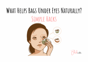 What Helps Bags Under Eyes Naturally? Simple Hacks - Blushastic